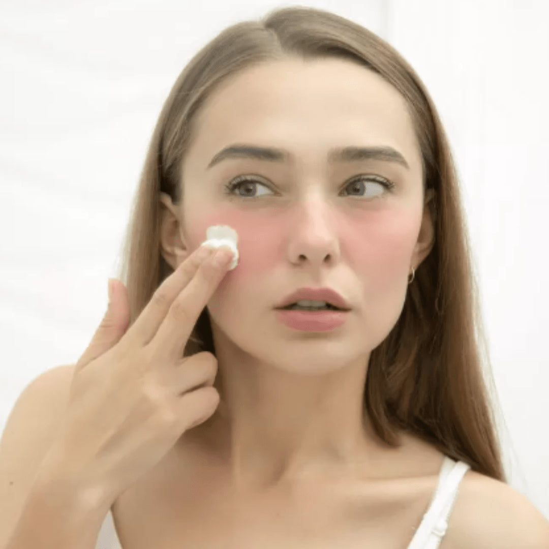 Care este diferența între Rozacee și Cuperoza – WowSkin Romania